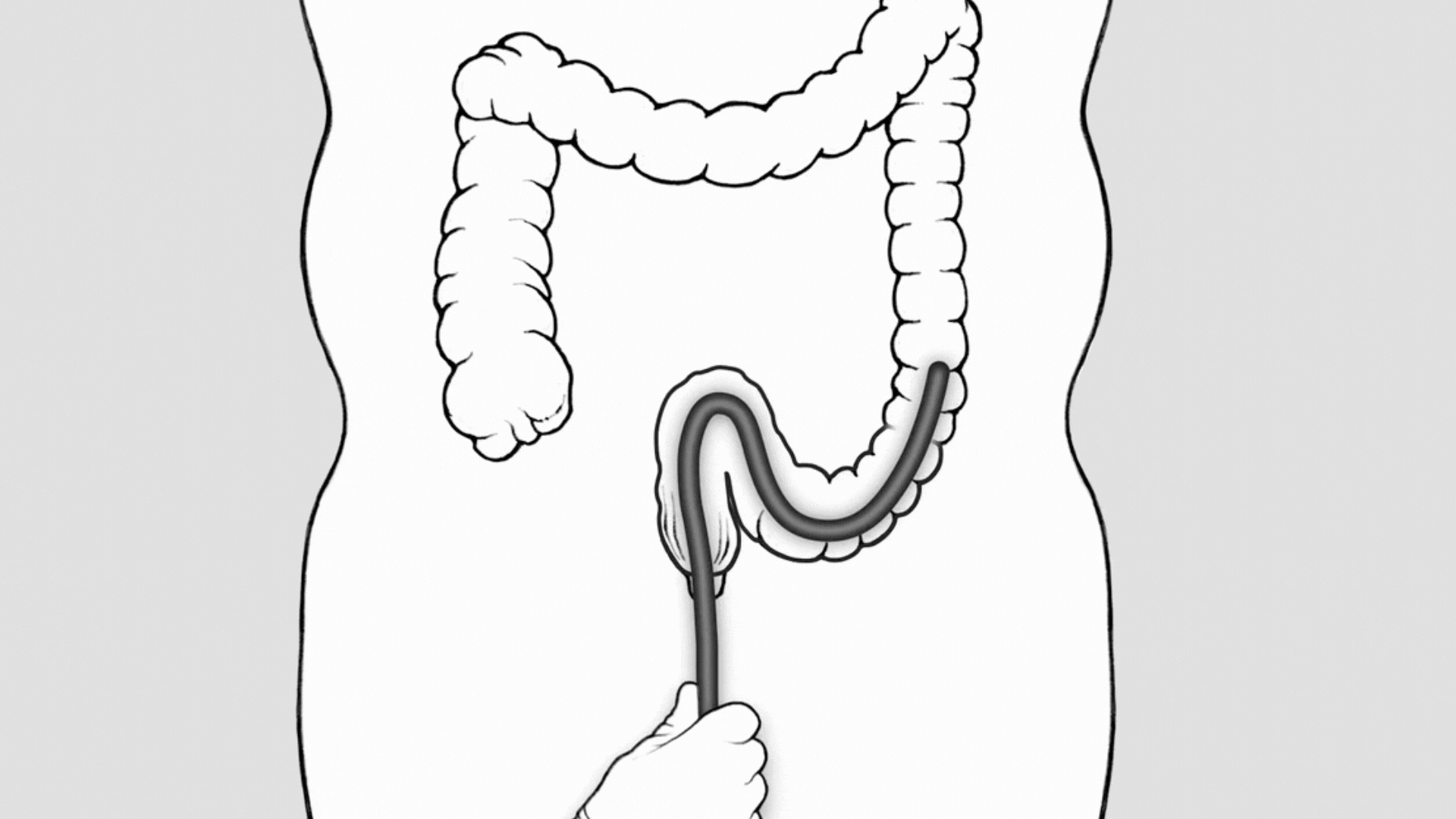Creating the Most Ergonomically Sound Endoscopy Department